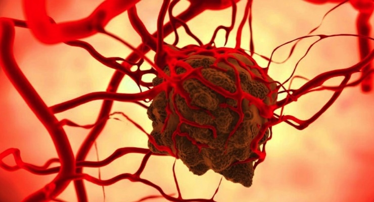 Endomag Receives CE Mark Approval for Magseed Breast Cancer ...