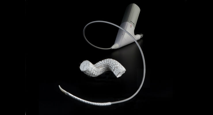 First U.S. Patient Receives GORE TAG Conformable Thoracic Stent Graft ...