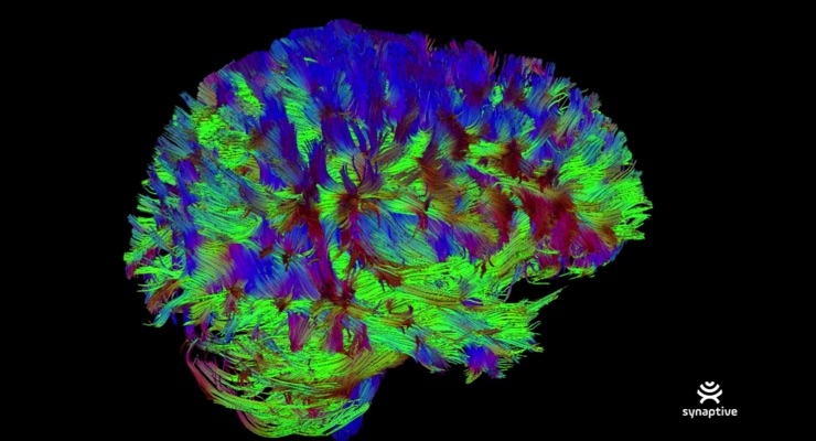 Synaptive Medical Receives Health Canada Approval for BrightMatter ...