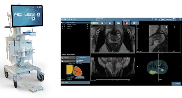 New Software Infuses AI Capabilities Into Koelis' Trinity Platform ...