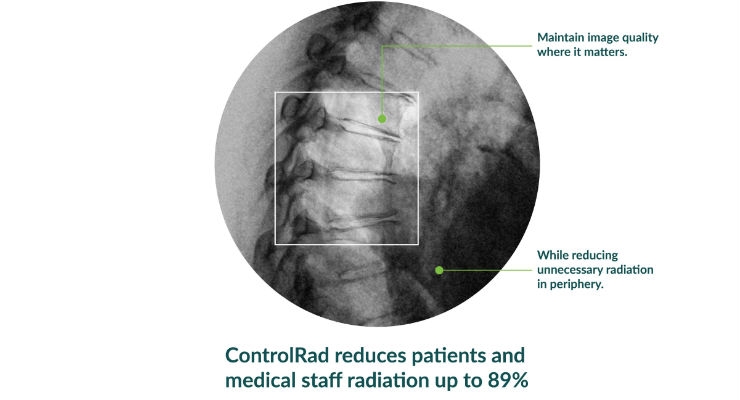 FDA OKs ControlRad's Radiation Reduction Technology that Integrates ...
