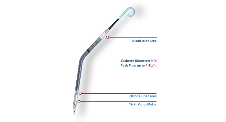 FDA Approves Abiomed's Impella CP Heart Pump with SmartAssist - Medical ...