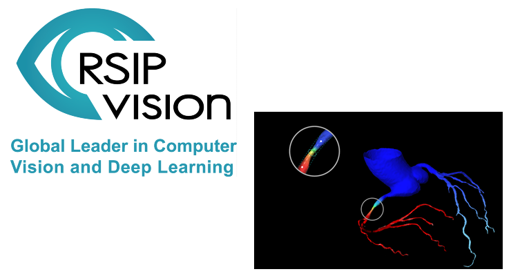 RSIP Vision Announces New Coronary Artery Segmentation Tool - Medical ...