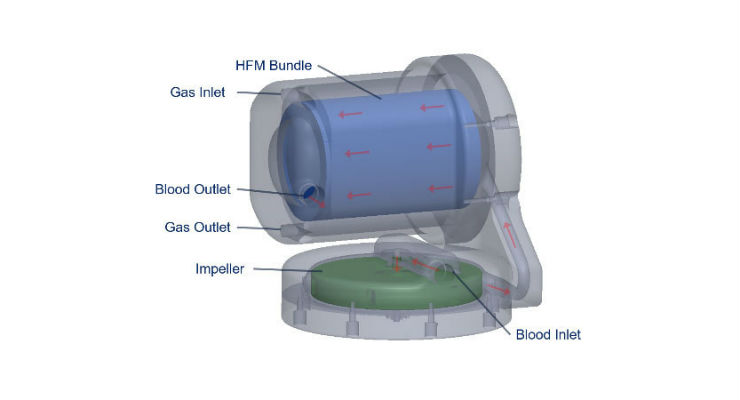 ALung Announces Commercial Development of its Next-Generation ...