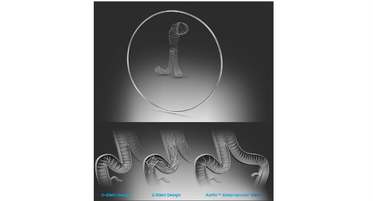 Lombard Medical Completes First 15 Cases in Japan for IntelliFlex LP ...