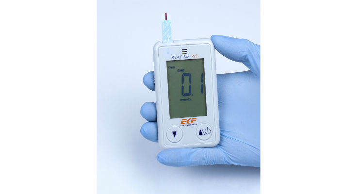 EKF Launches β-Ketone and Glucose POC Analyzer to U.S. Market - Medical ...