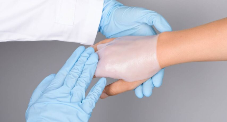 JeNaCell Releases Wound Dressing epicite balance - Medical Product ...