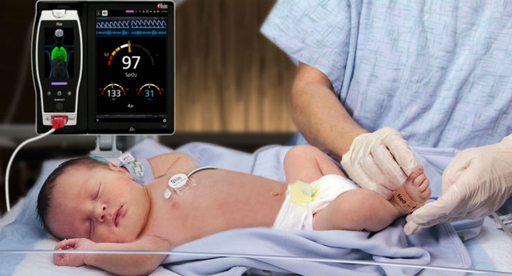 FDA Clears Masimo's rainbow Acoustic Monitoring Sensor for Infant and ...