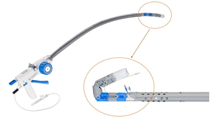 Merit Medical Buys EsophyX Z+ Endoscopic GERD Device for $105M ...