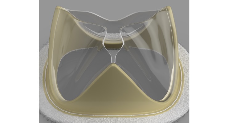 Foldax Releases Clinical Results for TRIA Mitral Surgical Heart Valve ...