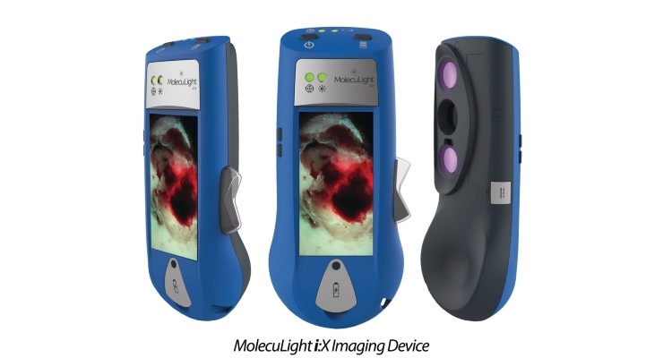 FDA OKs MolecuLight's Handheld Fluorescence Imaging Device - Medical ...