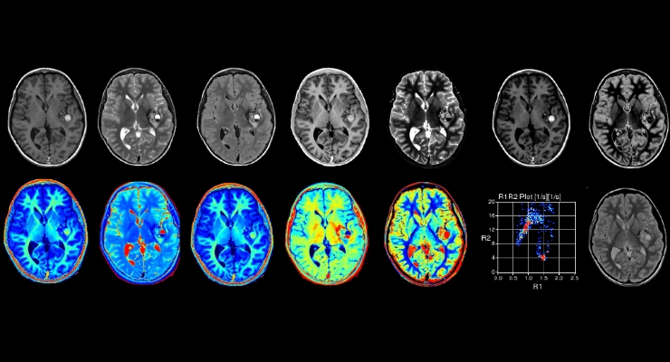 FDA Clears GE's New Speedy MRI Scanning - Medical Product Outsourcing