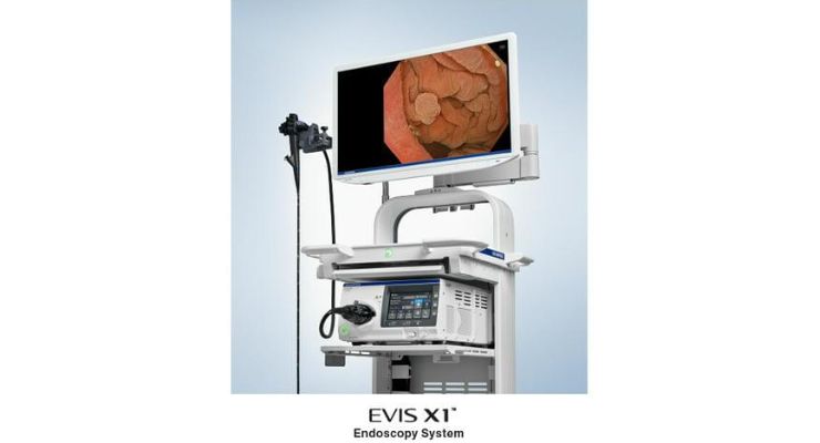 FDA OKs Olympus' New Endoscopy System, Compatible Endoscopes - Medical ...