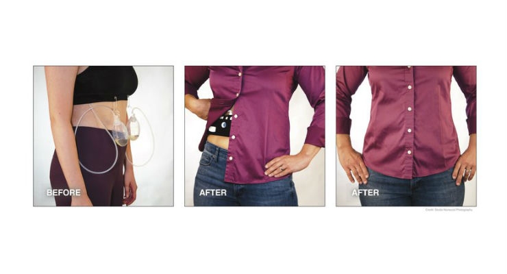 SOMAVAC Medical Solutions Receives FDA Clearance of Wearable Post ...