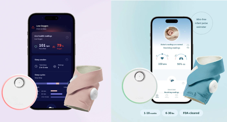 Two Infant Monitoring Devices Released to Market - Medical Product ...