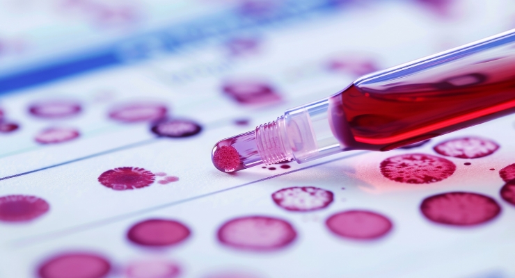Guardant Health Releases Major Upgrade to Liquid Biopsy Test - Medical ...