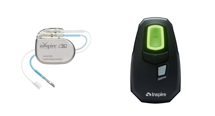 Neuromodulation Gaining Popularity as Obstructive Sleep Apnea Treatment - Medical Product ...