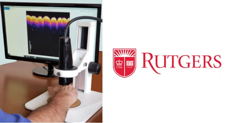 'Virtual Biopsy' Device Detects Skin Tumors - Medical Product Outsourcing
