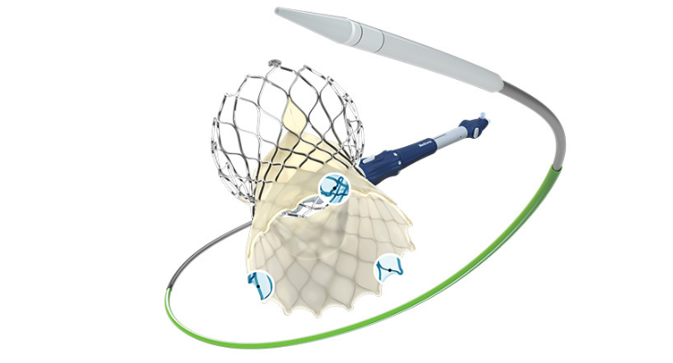 Medtronic’s Evolut FX TAVR System Improves Commissure Alignment ...