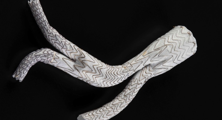 GORE EXCLUDER Iliac Branch Endoprosthesis Approved in Japan - Medical ...