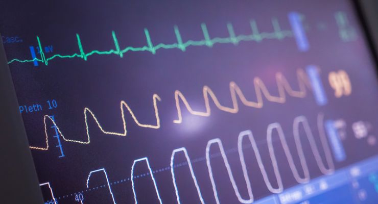 FDA OKs CardioSTAT Continuous, Ambulatory ECG Recorder - Medical ...