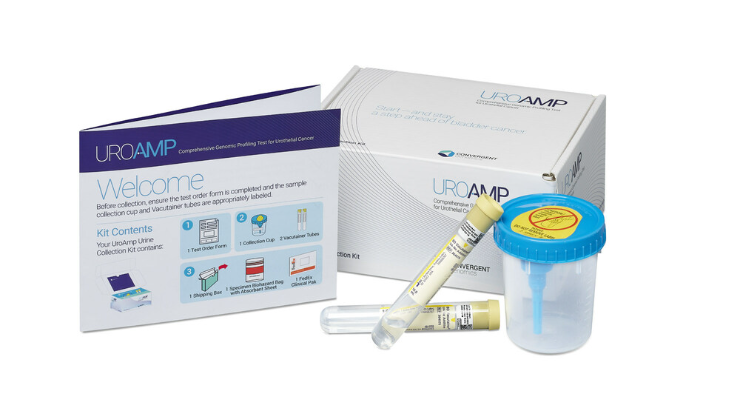 Urine Test Can Detect Bladder Cancer 12 Years Before Symptoms Appear ...