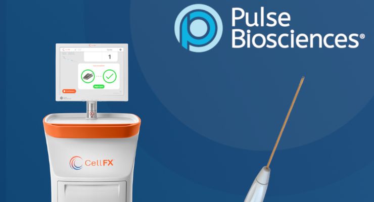 Pulse Biosciences Completes First U.S. Procedure with Pulsed Field ...