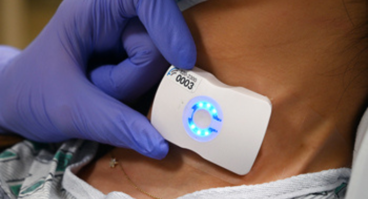 FloPatch Advanced Ultrasound Tech Makes World Debut in Northern ...