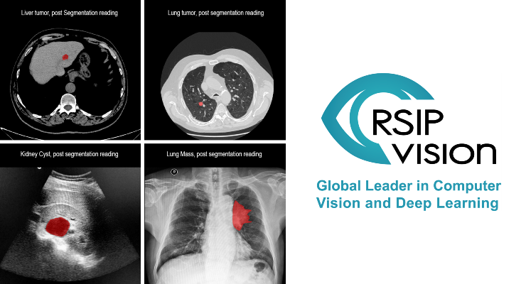 RSIP Vision Announces Versatile Medical Image Segmentation Tool ...