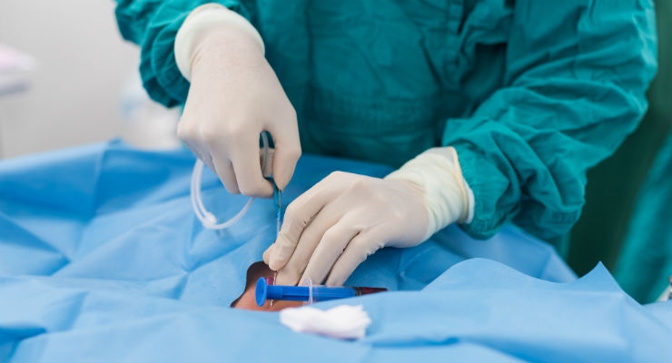 PTFE Guidewire Application Process Eliminates Delamination - Medical ...