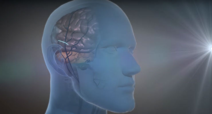 Visual Stimulation with LEDs May Become New Alzheimer’s Treatment ...
