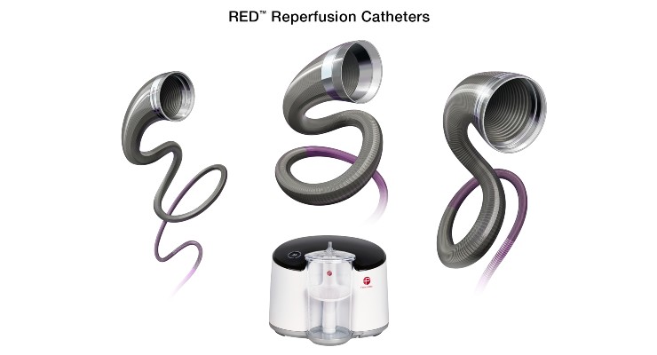 Penumbra Rolls Out RED Reperfusion Catheters in Europe - Medical ...