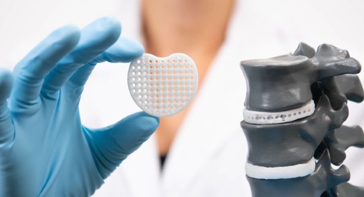 Evonik Closes LACTEL Absorbable Polymers Acquisition - Medical Product ...