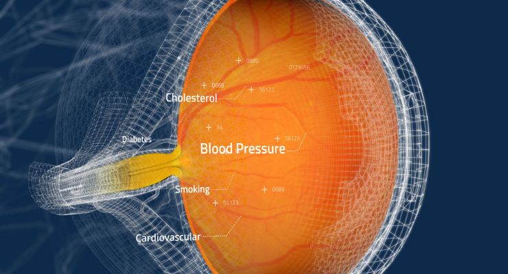 Toku's CLAiR Platform Wins FDA Breakthrough Status - Medical Product ...