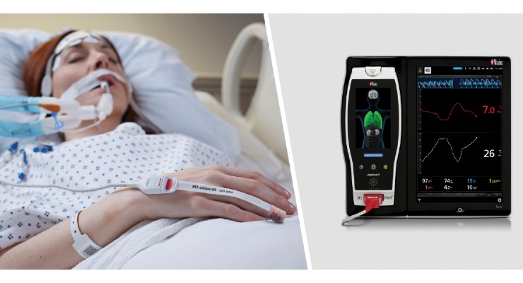 FDA Clears Masimo's PVi Perfusion Measure for Mechanically Ventilated ...