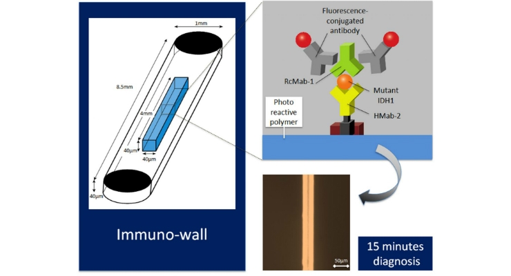 Device Enables Rapid Identification of Brain Cancer Type and Tumor ...