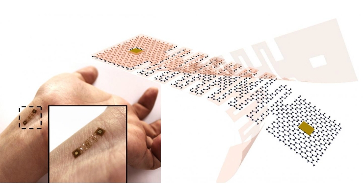 New Method for Wearable Sensors Inspired by Origami Variation - Medical ...