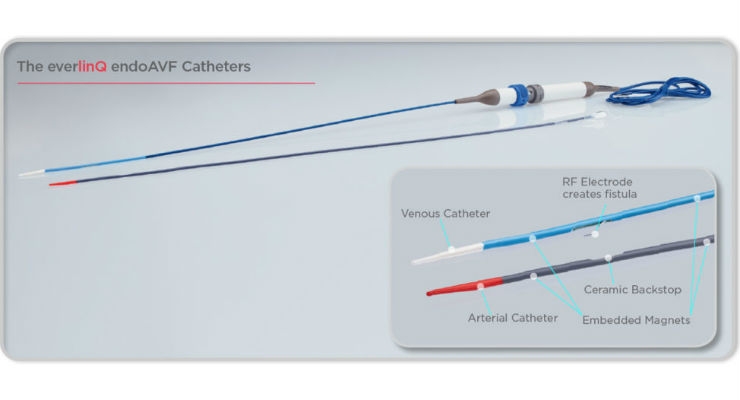 Magnet Tech Eases Blood Access for Hemodialysis Patients - Medical ...