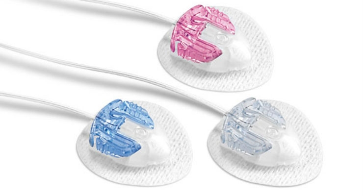 Medtronic Introduces MiniMed Mio Advance Infusion Set for Diabetics ...