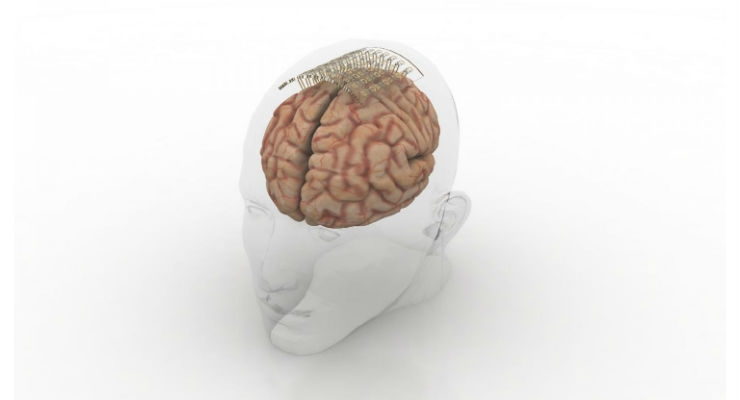 Building a Better Brain Probe with Graphene and Gold - Medical Product ...