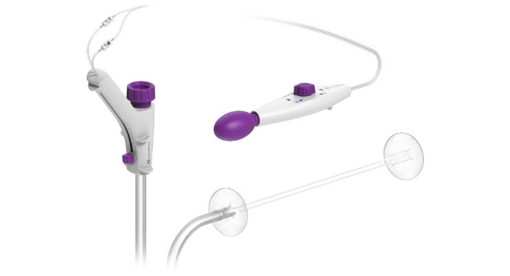 FDA Clears Lumendi's DiLumen for Endolumenal Therapy - Medical Product ...