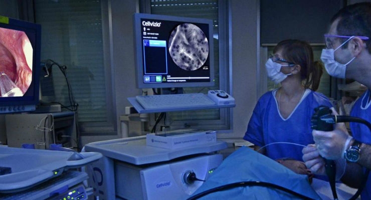 Cellvizio CE Marked for Use During Robotic-Assisted Surgery - Medical ...