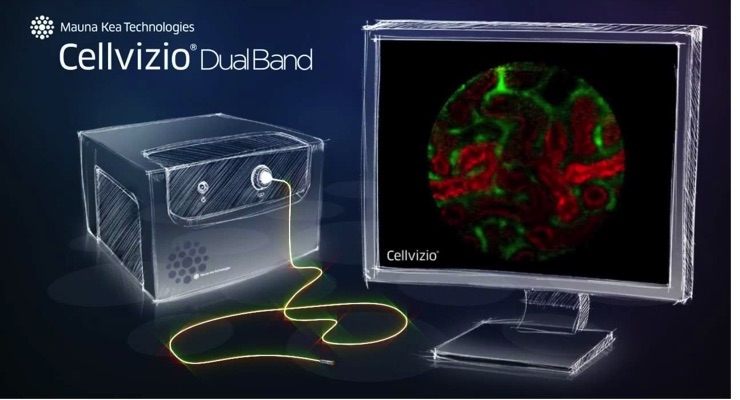 Mauna Kea Receives 14th FDA Clearance for the Cellvizio 100 Series ...