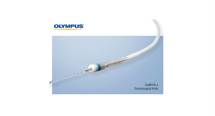 Olympus Launches DualKnife J ESD Electrosurgical Knife to Shorten ...