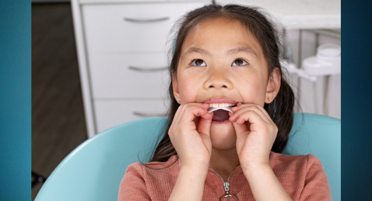 Align Technology Gains Updated Canadian License for Invisalign Palatal ...