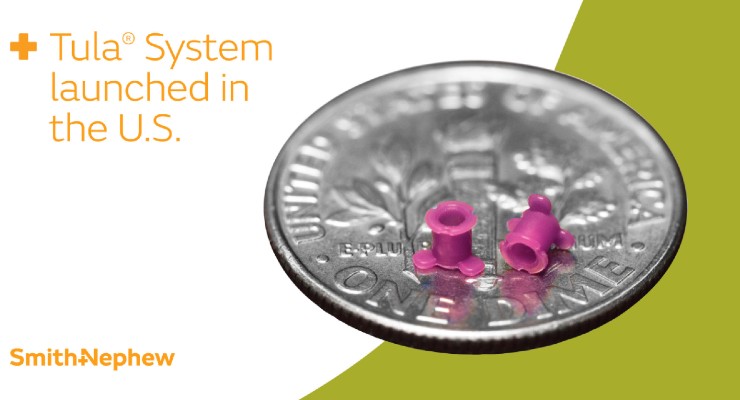 Smith+Nephew Launches Tula Ear Tube Placement System - Medical Product ...