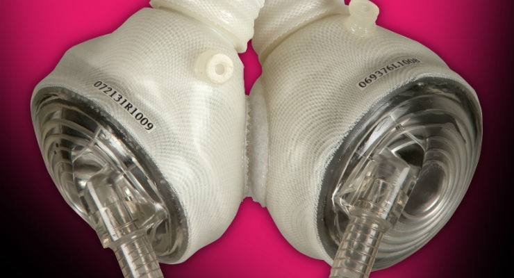 SynCardia Systems Acquired by Versa Capital Management - Medical ...