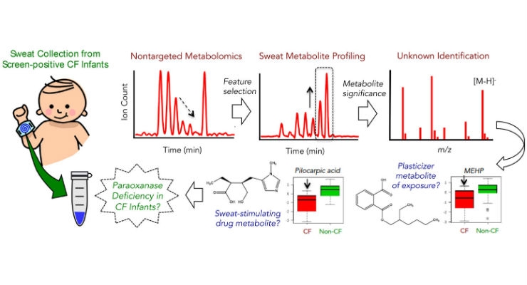 Toward a Better Sweat Test for Babies with Cystic Fibrosis - Medical ...