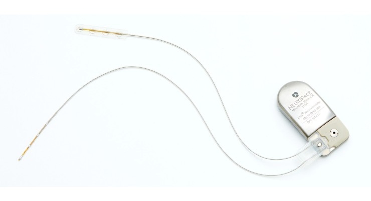 FDA OKs MRI Labeling for NeuroPace's RNS System - Medical Product ...