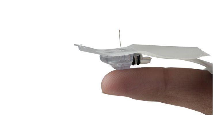 Medtronic’s Enlite Sensor for Continuous Glucose Monitoring Approved in ...